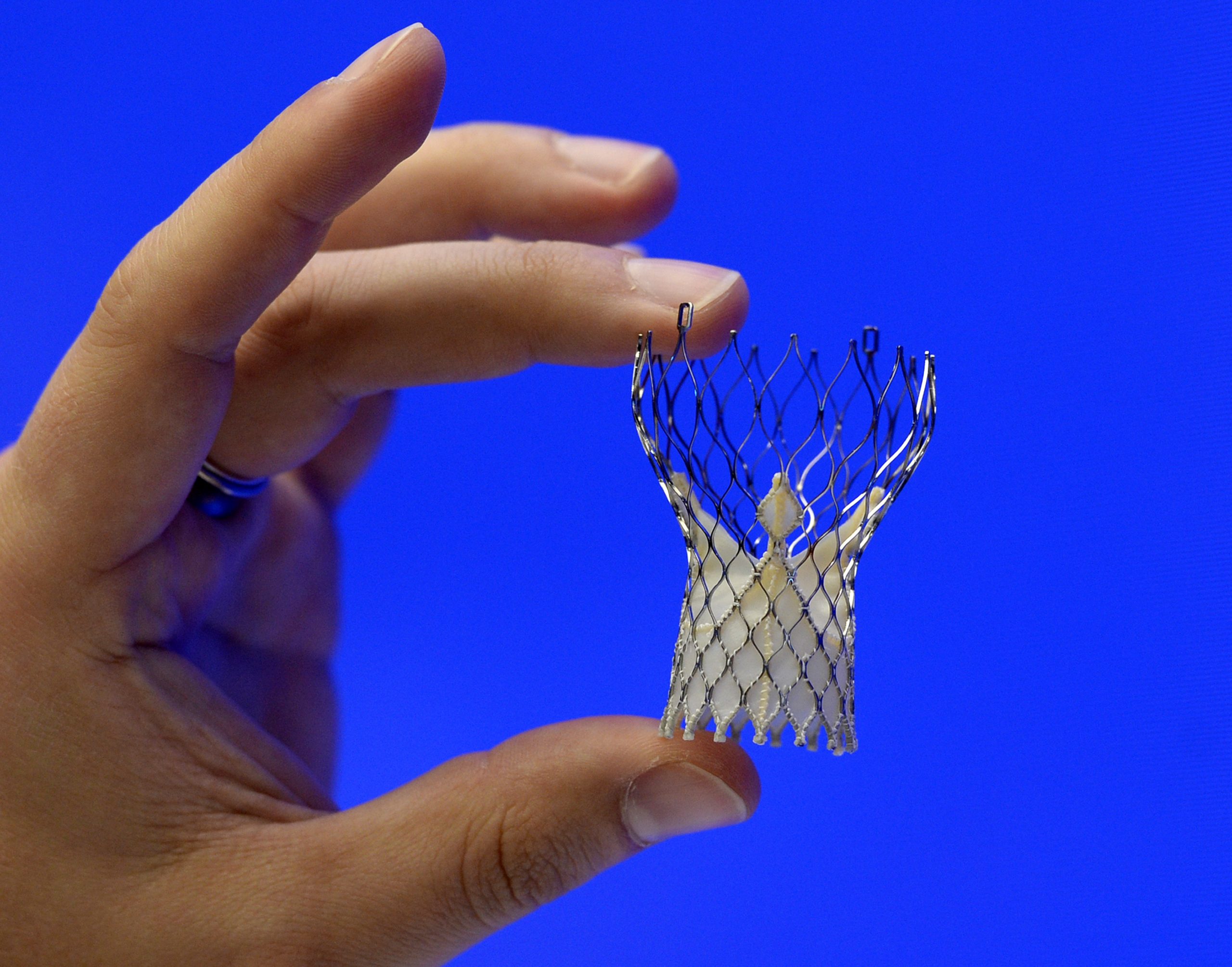 Study backs nonsurgical way to fix heart valves - Washington Examiner